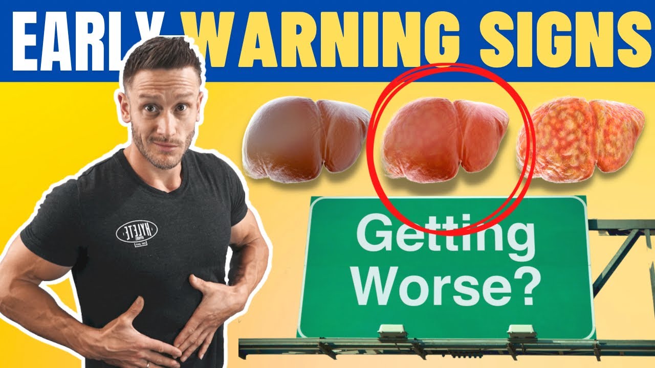 The Four EARLY Signs Of Fatty Liver Disease (NAFLD) - How To Fix It Early